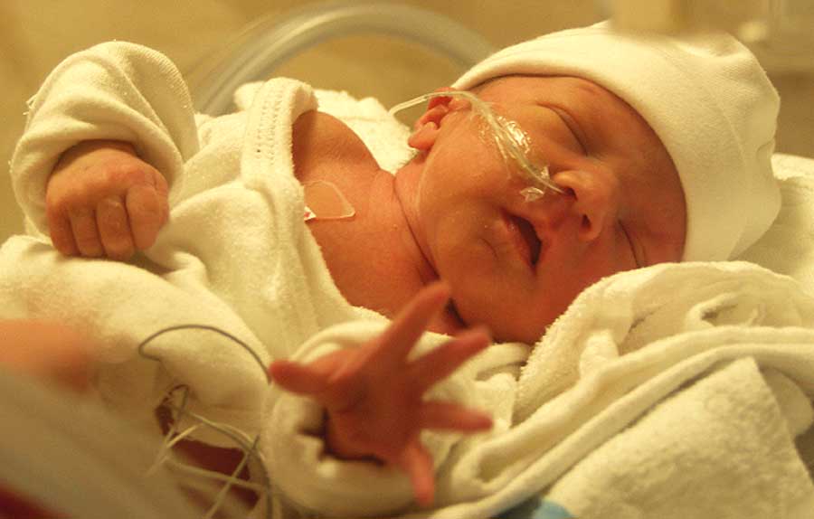 Caring For Premature Babies Caring For Premature Babies